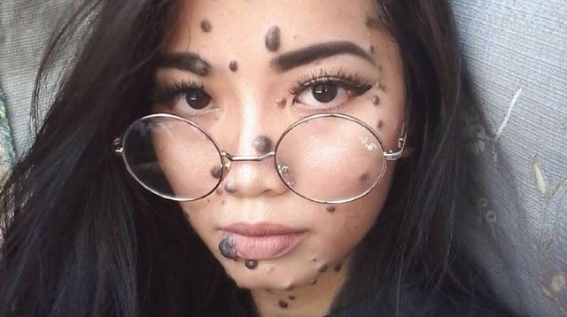 Mole-Covered Woman Auditioned For Miss Universe 2018